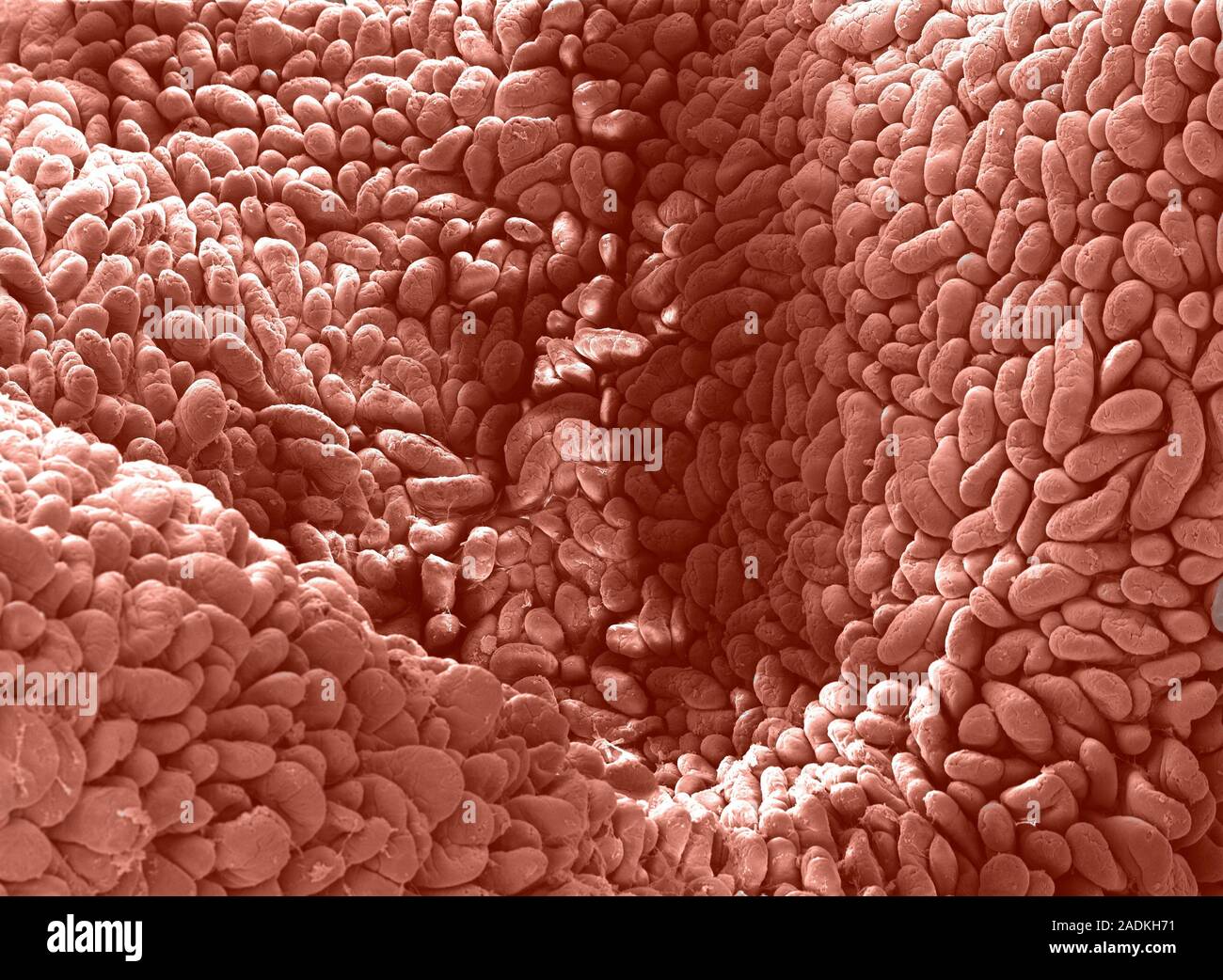 Ileum. Coloured scanning electron micrograph (SEM) of the surface of ...
