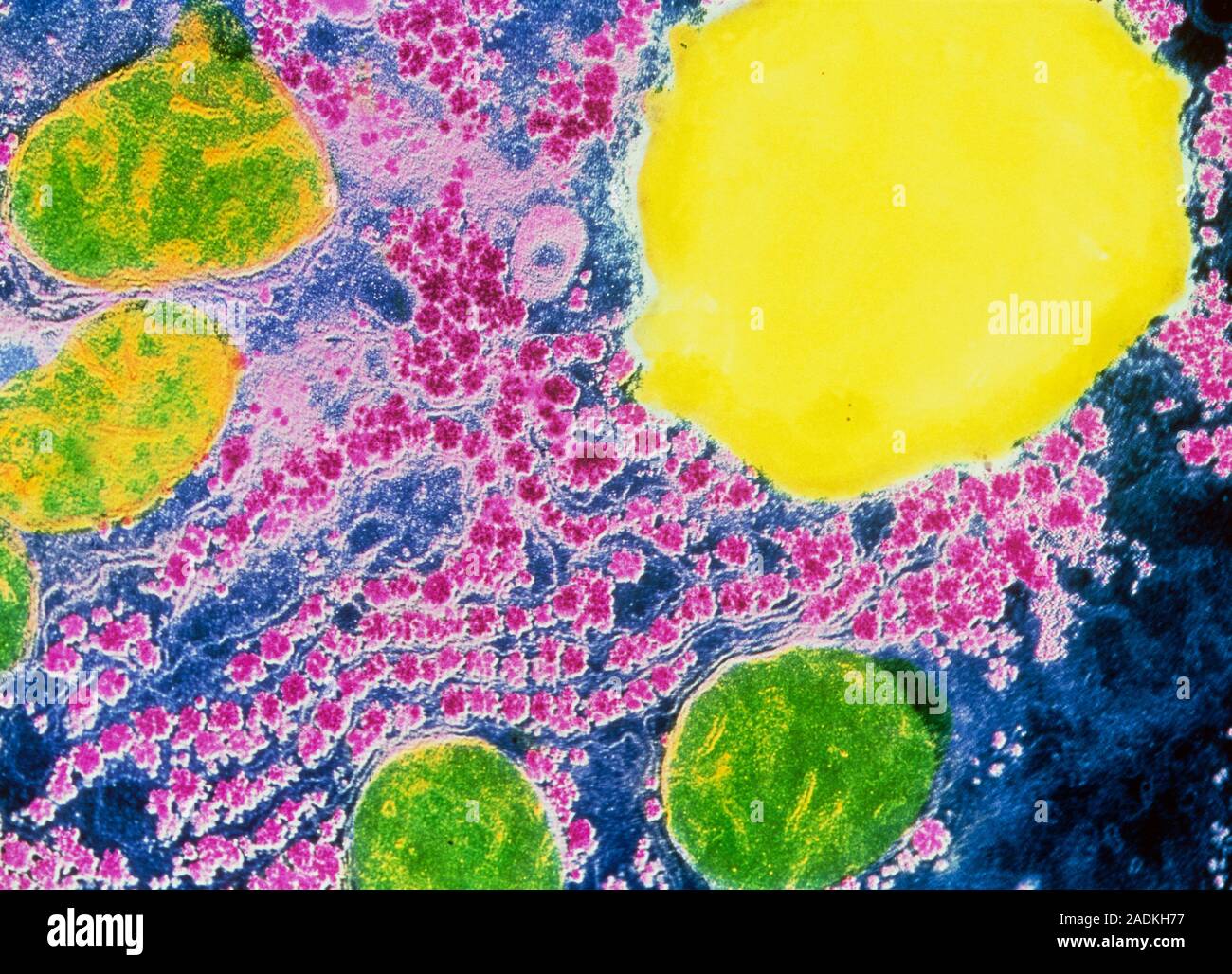 False colour transmission electron micrograph (TEM) of a section ...