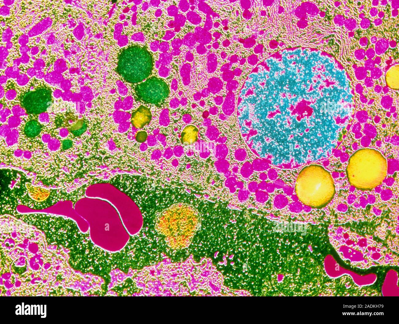 False colour transmission electron micrograph (TEM) of a section ...