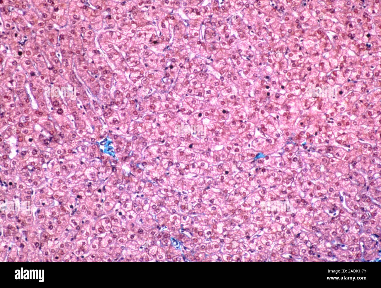 Light micrograph of a cross-section of a normal human liver, showing ...