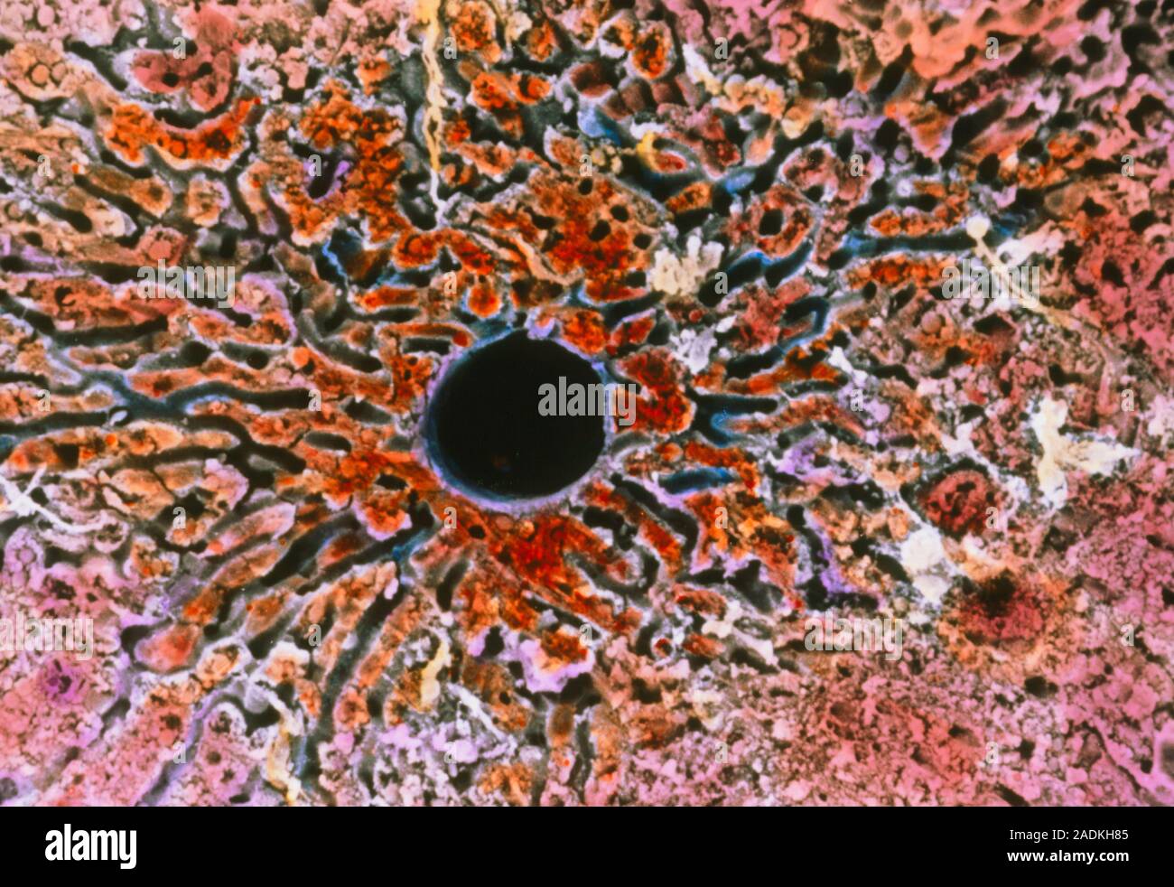 Liver cells. False-colour scanning electron micrograph (SEM) of a ...