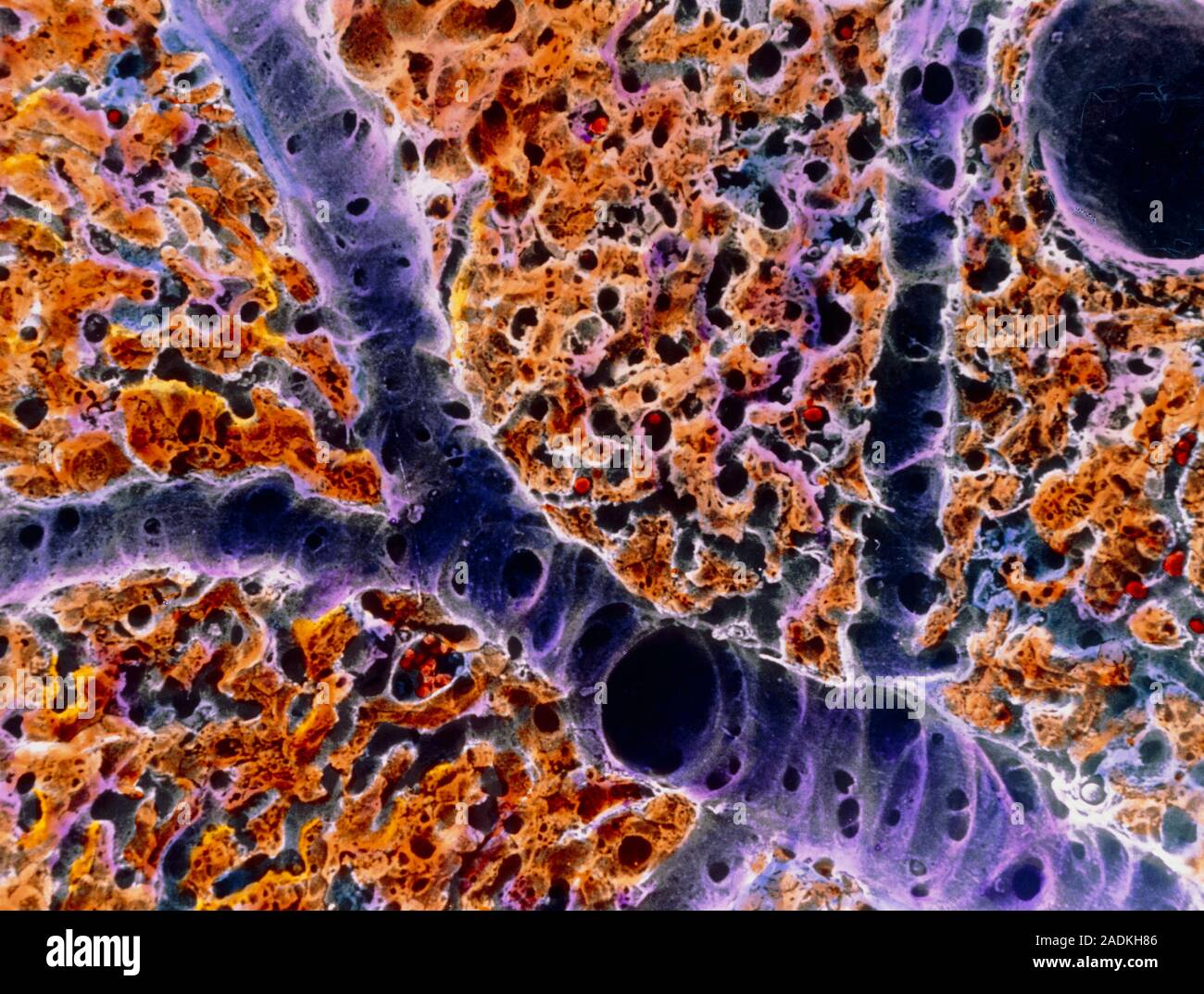 Liver tissue. False-colour scanning electron micrograph (SEM) of blood ...
