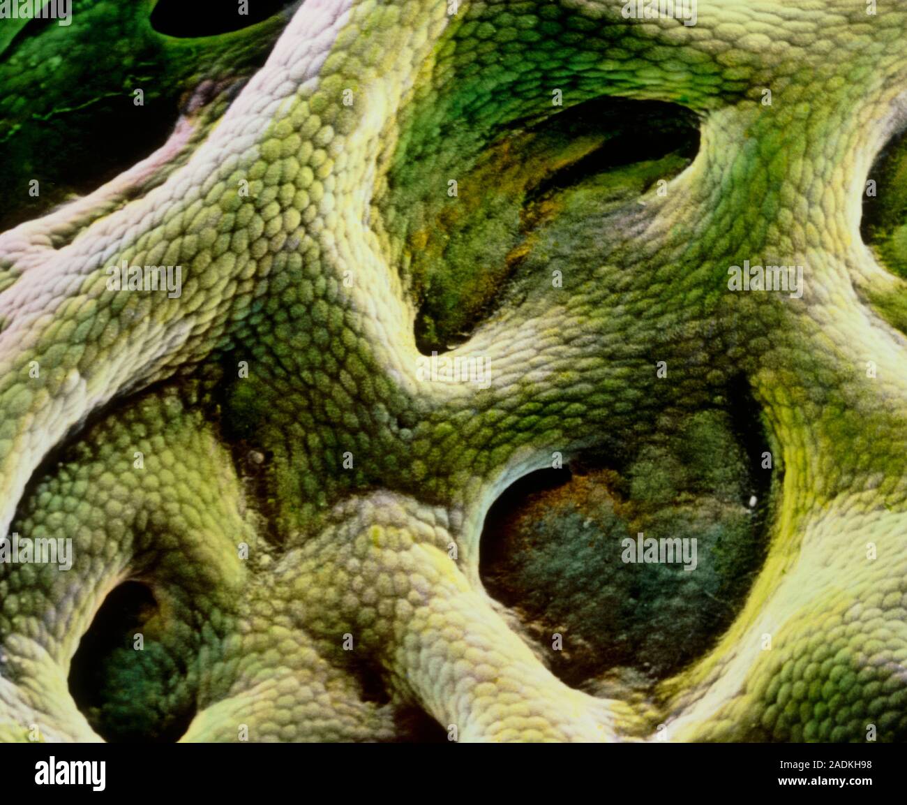 False-colour scanning electron micrograph (SEM) of the wall of the gall ...