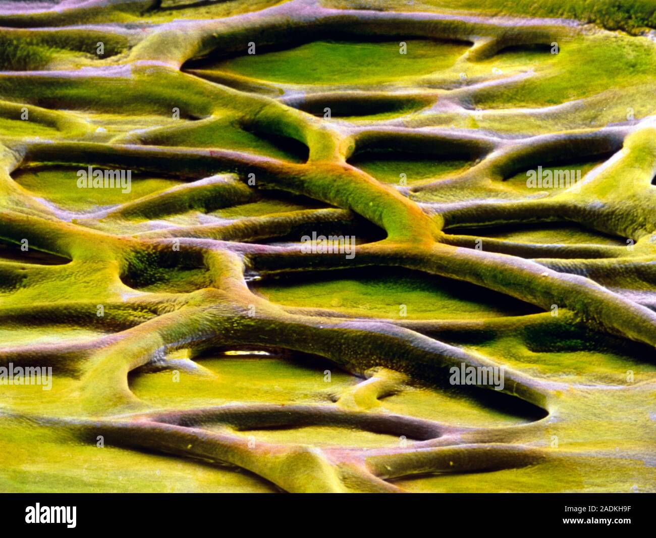 False-colour scanning electron micrograph (SEM) of the wall of the gall ...