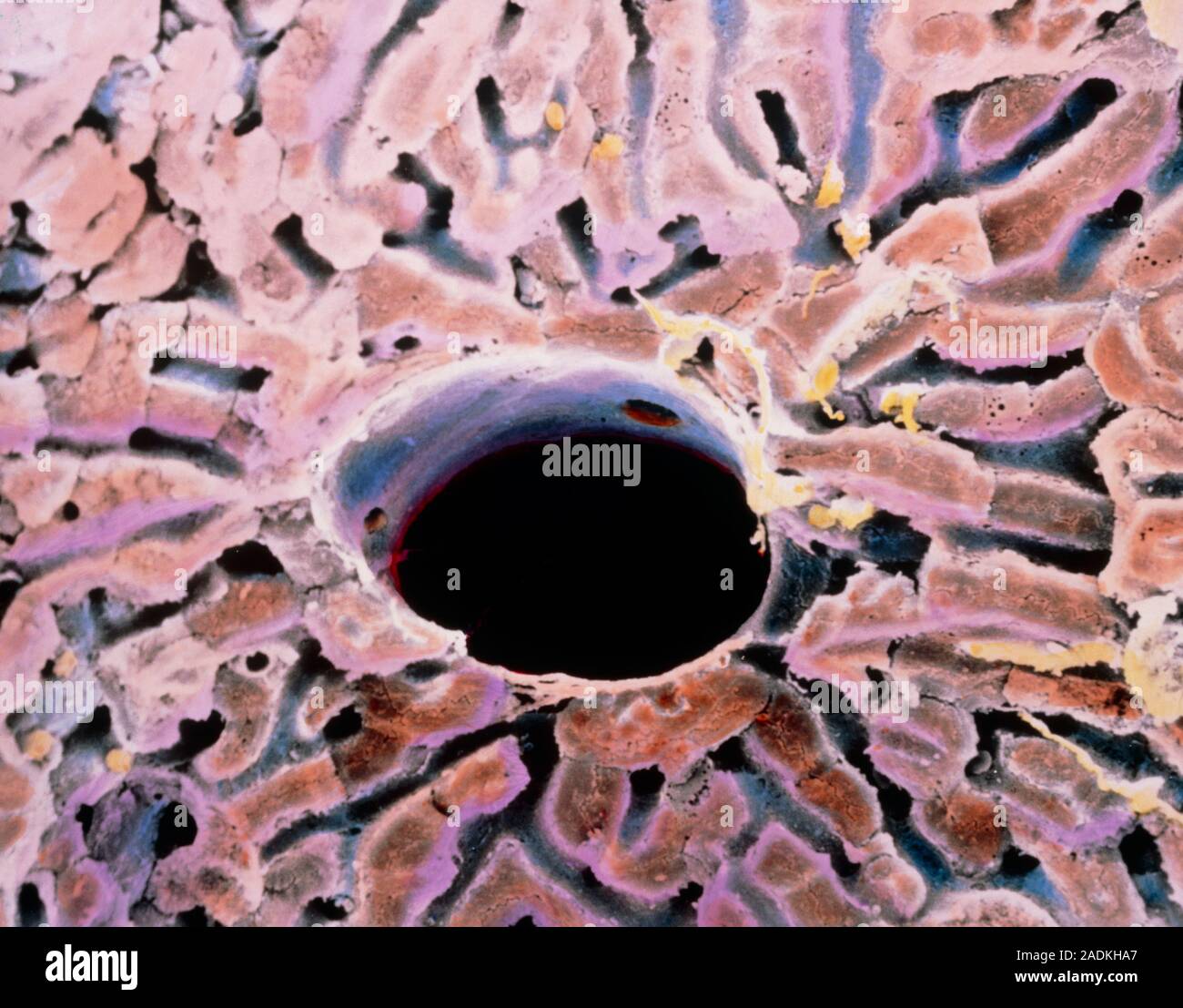 False-colour scanning electron micrograph (SEM) of a lobule of the ...