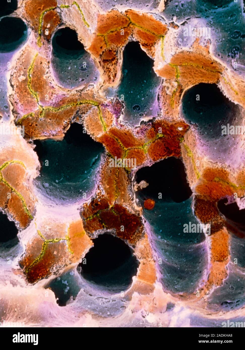 False-colour scanning electron micrograph (SEM) of the cell structure ...