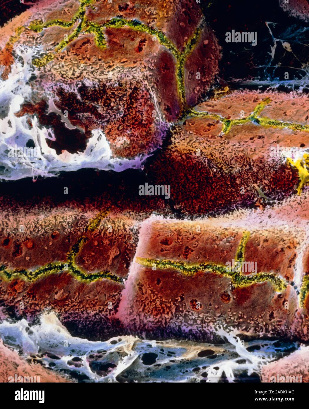 False-colour scanning electron micrograph (SEM) of the cell structure ...