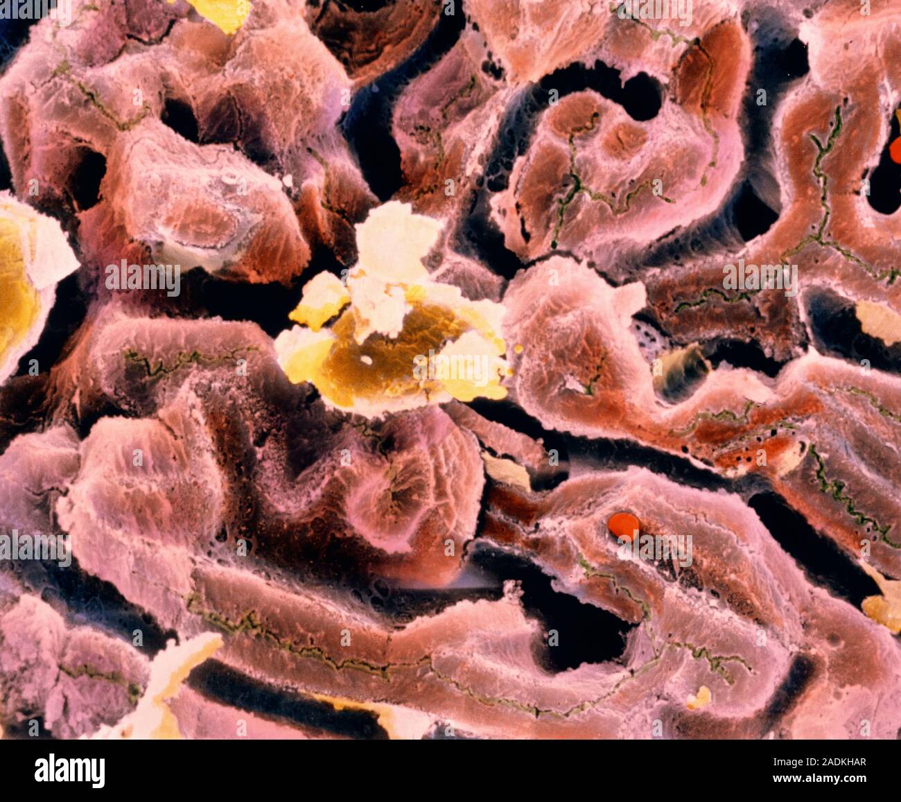 False-colour scanning electron micrograph (SEM) of the cell structure ...