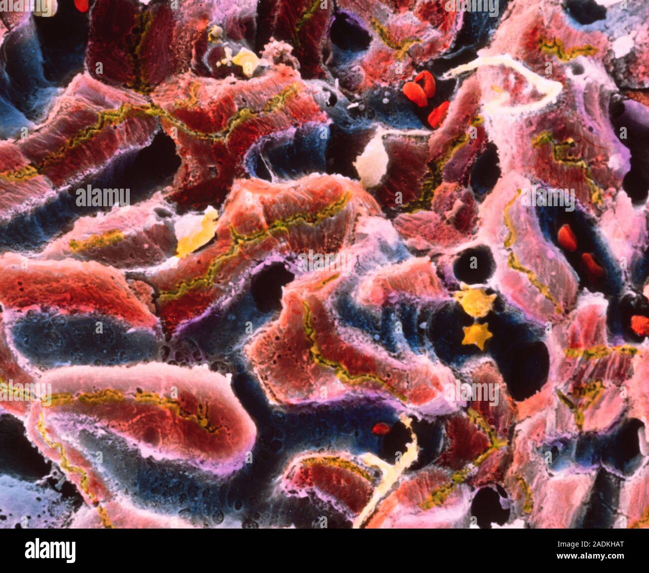 False-colour scanning electron micrograph (SEM) of the cell structure ...