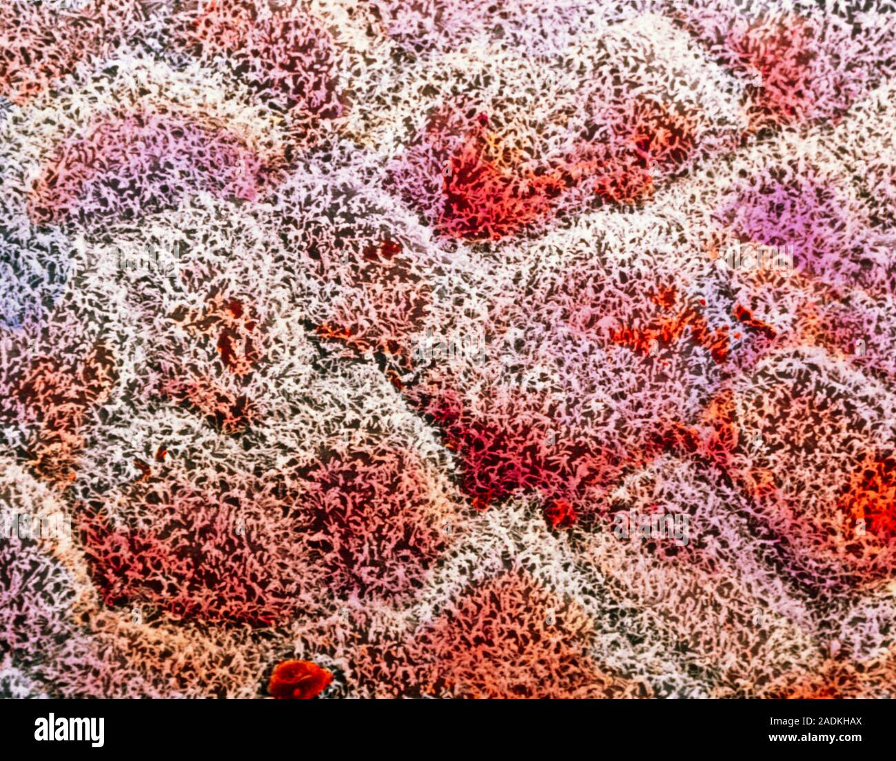 False-colour scanning electron micrograph (SEM) of the surface ...