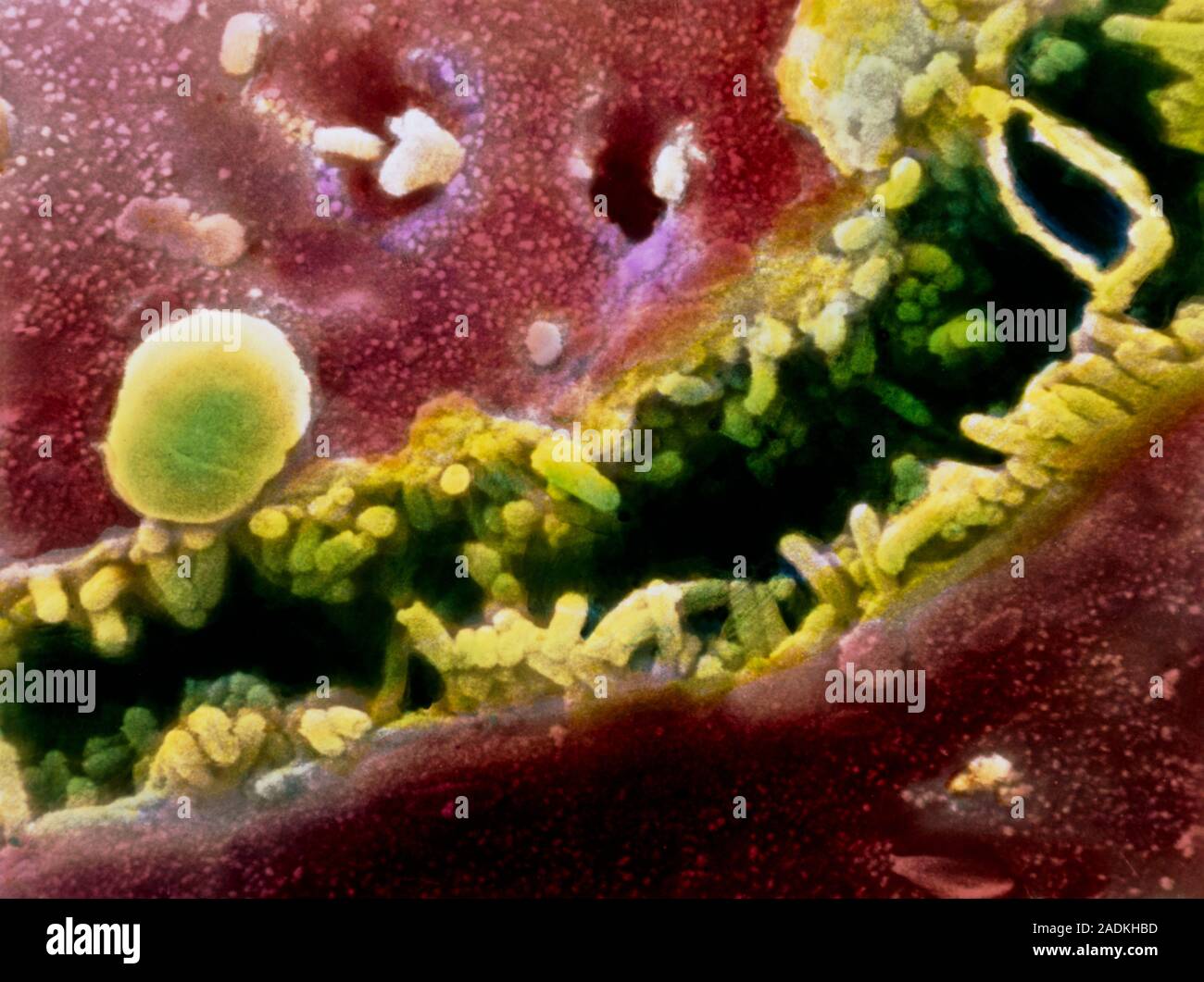 Bile canaliculus. Coloured scanning electron micrograph of a human ...