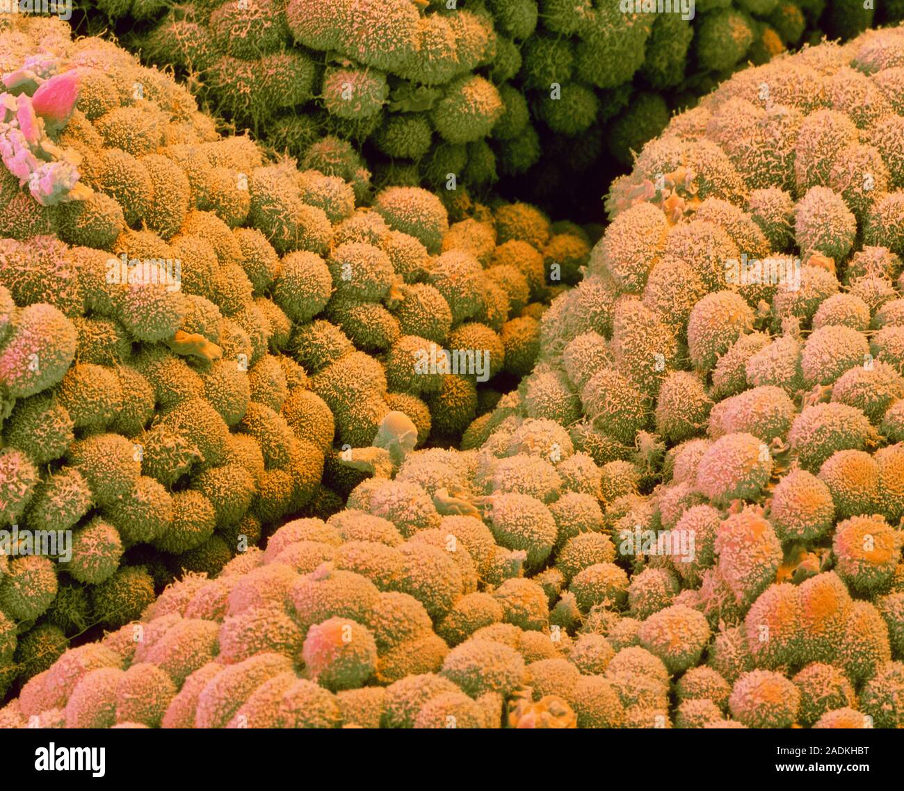 Gall bladder. Coloured scanning electron micrograph (SEM) of the lining ...