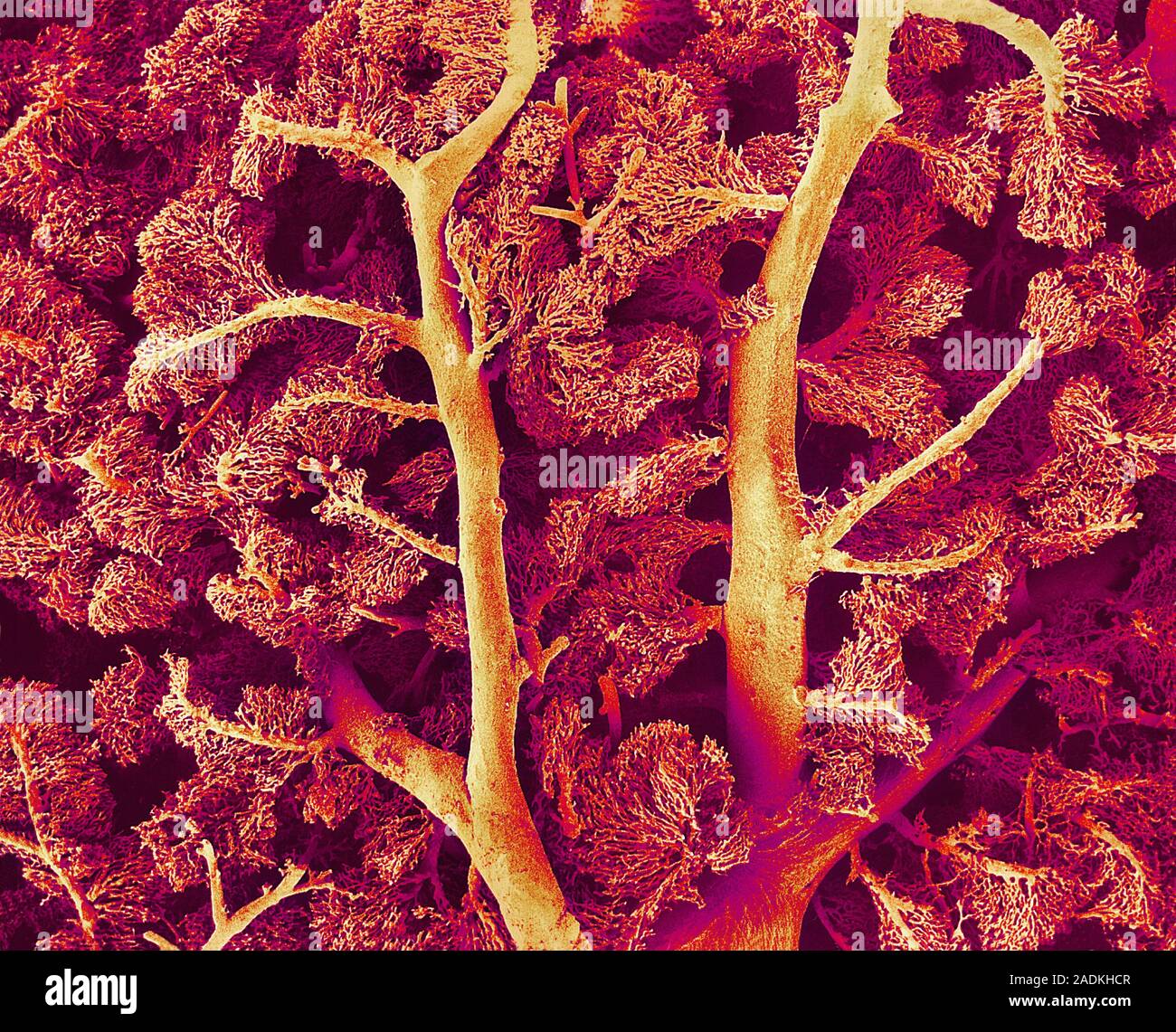Liver blood vessels. Coloured scanning electron micrograph (SEM) of a ...