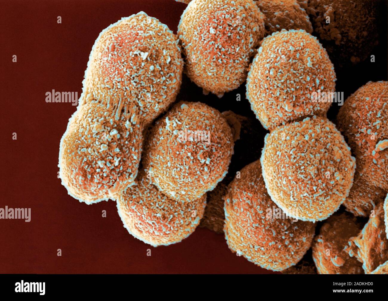 Liver cells. Coloured scanning electron micrograph (SEM) of liver cells ...