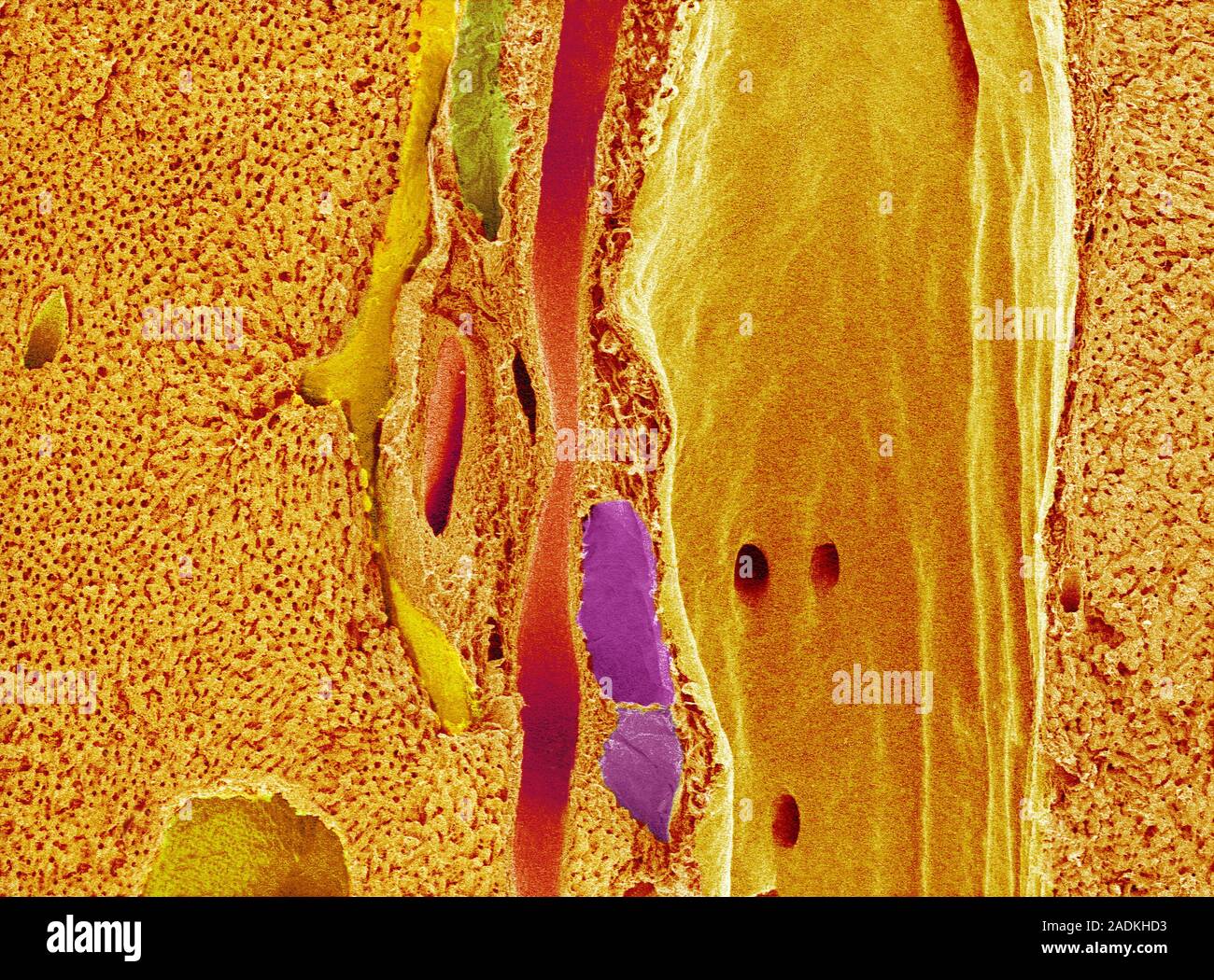 Liver. Coloured scanning electron micrograph (SEM) of the liver. This ...