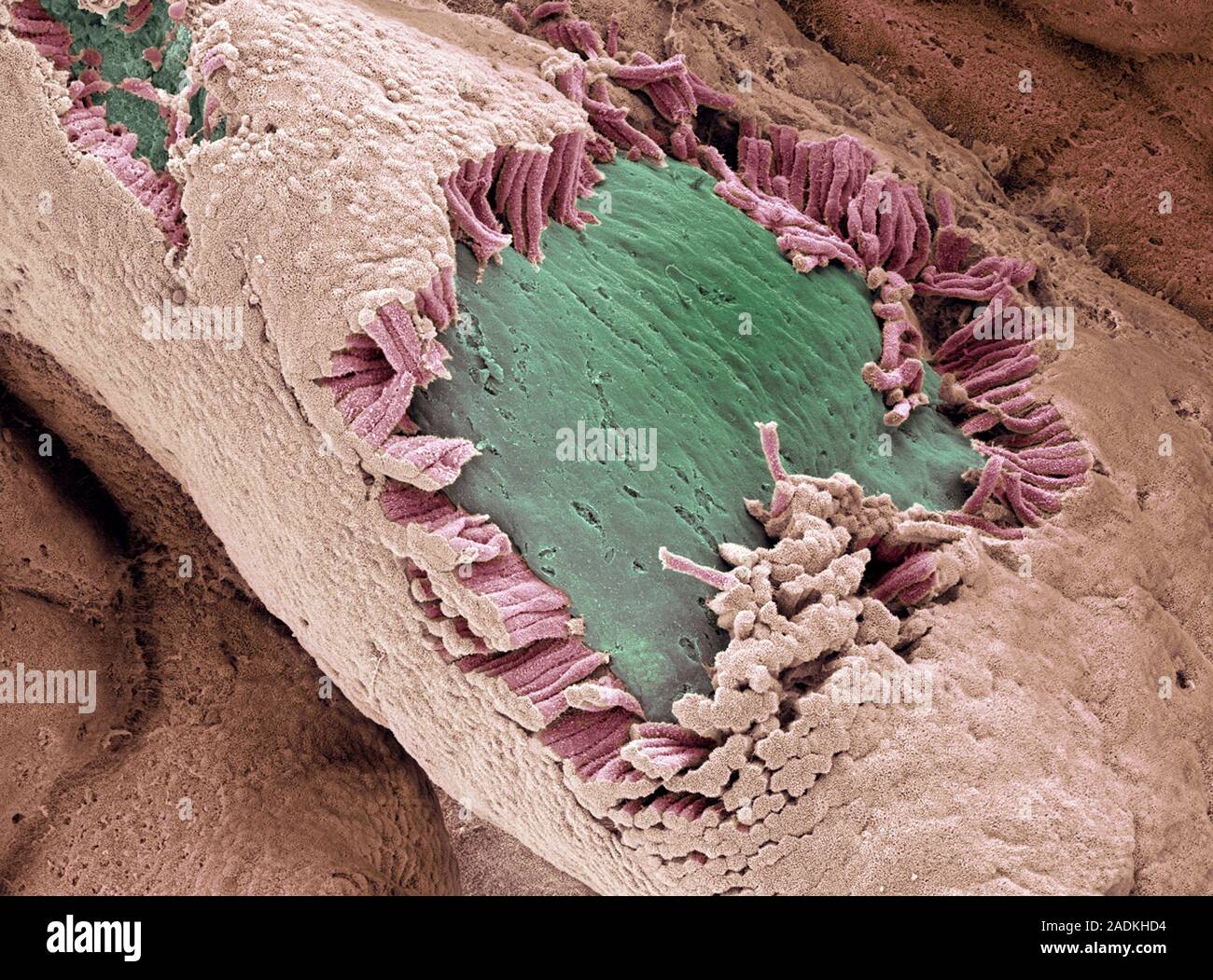 Gall bladder. Coloured scanning electron micrograph (SEM) of the ...