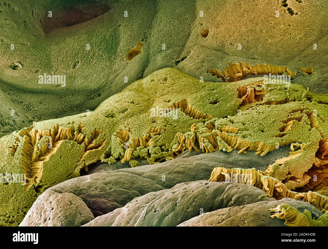 Gall bladder. Coloured scanning electron micrograph (SEM) of the ...