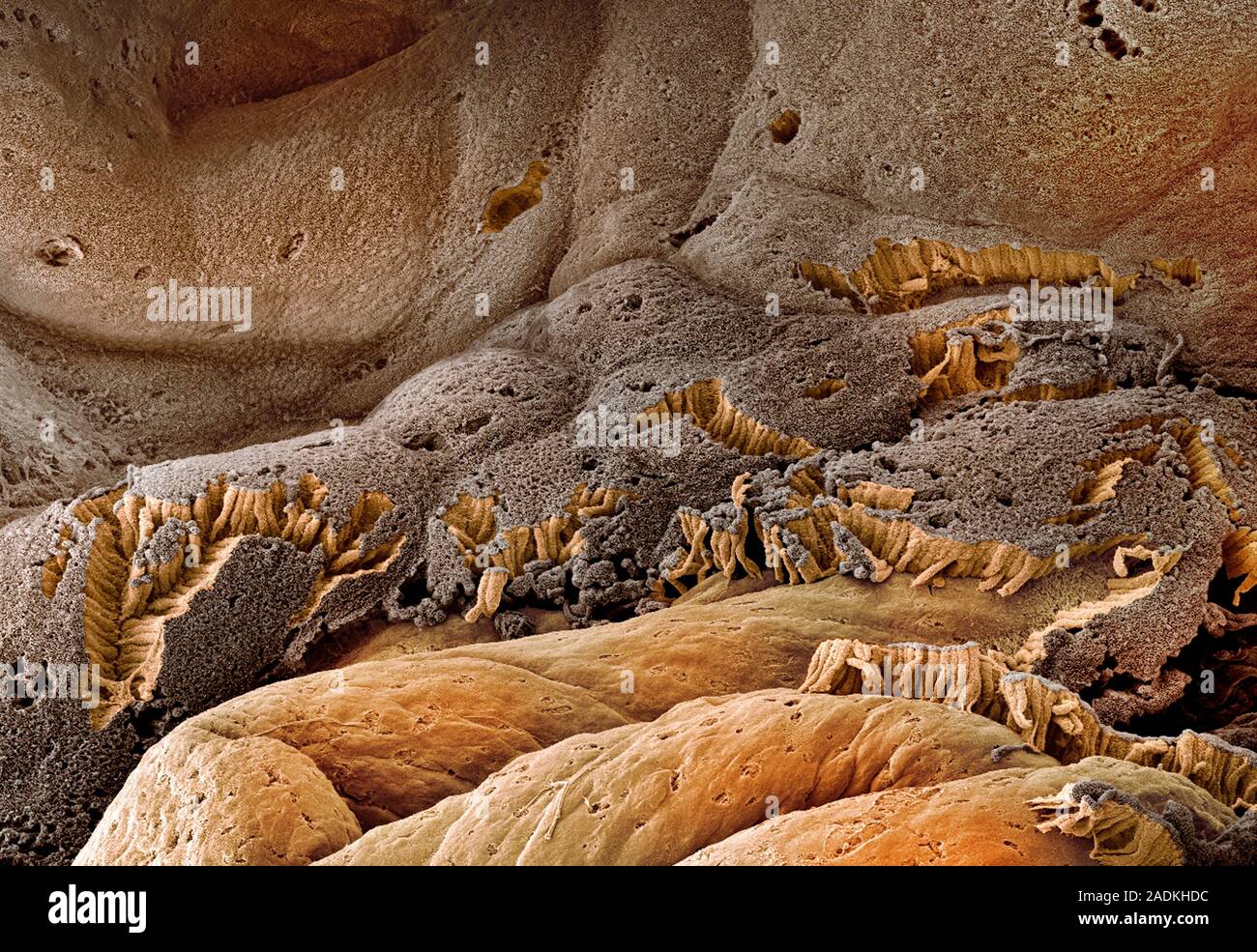 Gall bladder. Coloured scanning electron micrograph (SEM) of the ...