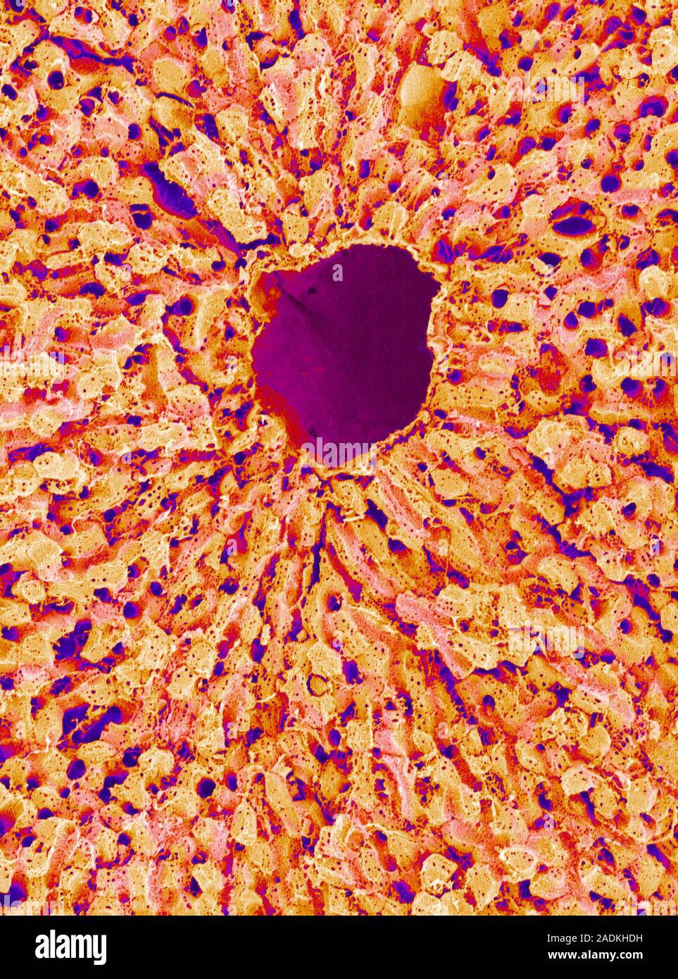 Liver vein. Coloured scanning electron micrograph (SEM) of a vein in ...