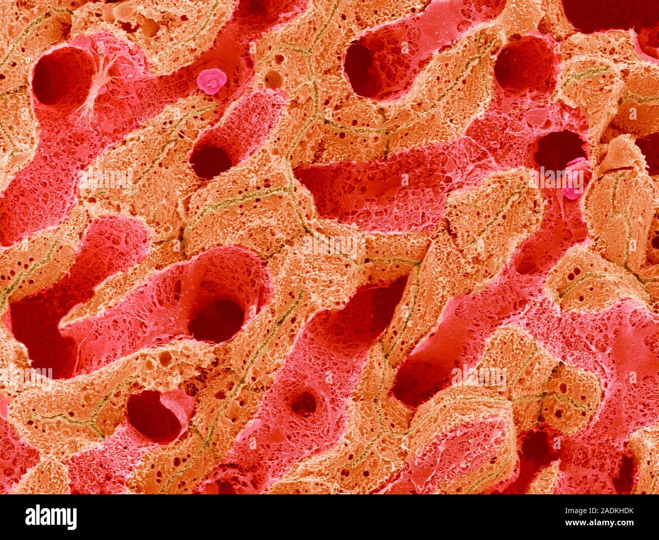 Liver blood supply. Coloured scanning electron micrograph (SEM) of ...