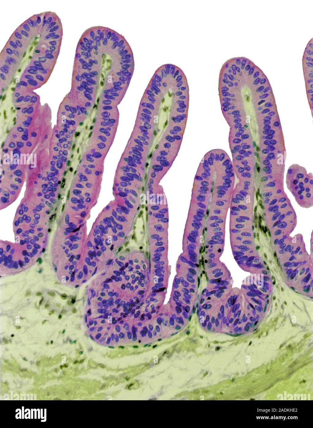 Gall bladder surface. Coloured light micrograph of a section through a ...
