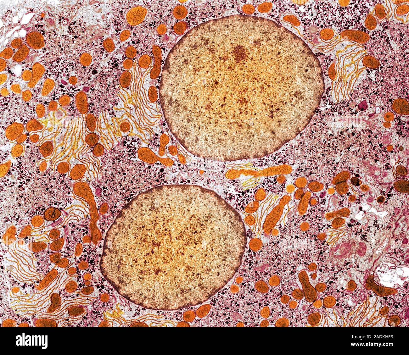 Liver cell, coloured transmission electron micrograph (TEM). A healthy ...