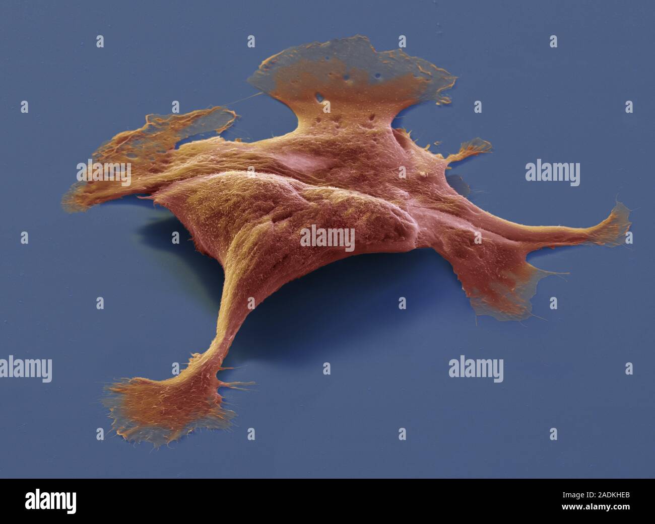 Liver cells, coloured scanning electron micrograph. Liver cells, or ...