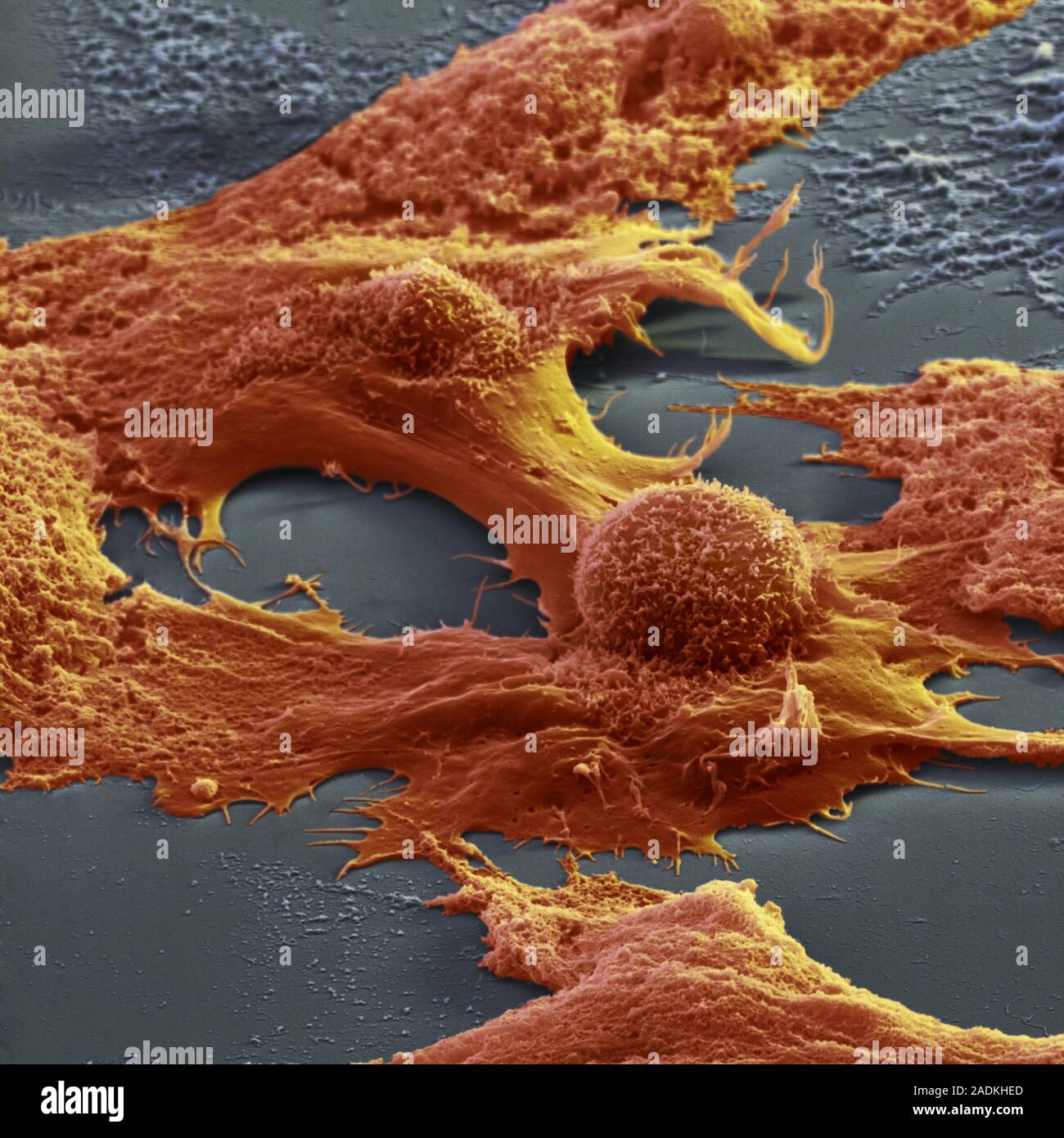 Liver cells, coloured scanning electron micrograph. Liver cells, or ...