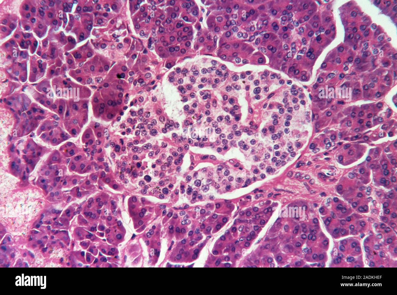 Light micrograph of a section of the pancreas showing the Islet of ...