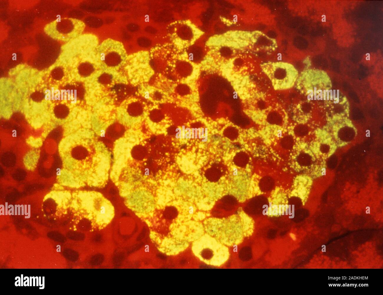 Light micrograph of beta cells from an islet of Langerhans in the ...