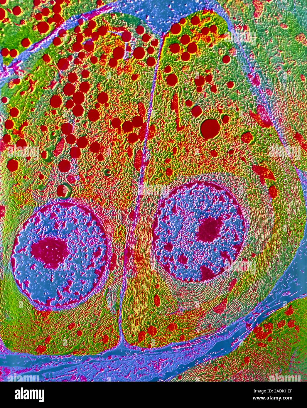 False-colour transmission electron micrograph (TEM) featuring two ...
