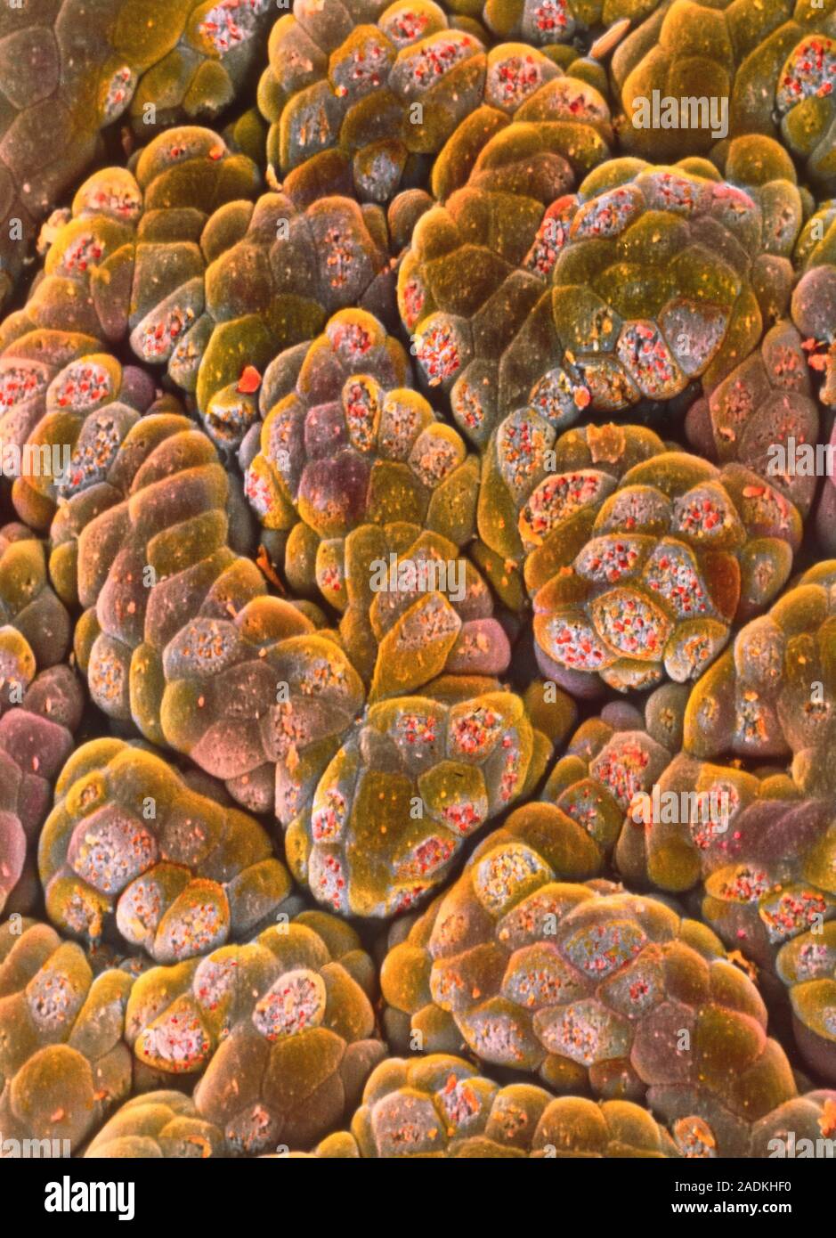 False-colour scanning electron micrograph (SEM) of acini cells of the ...