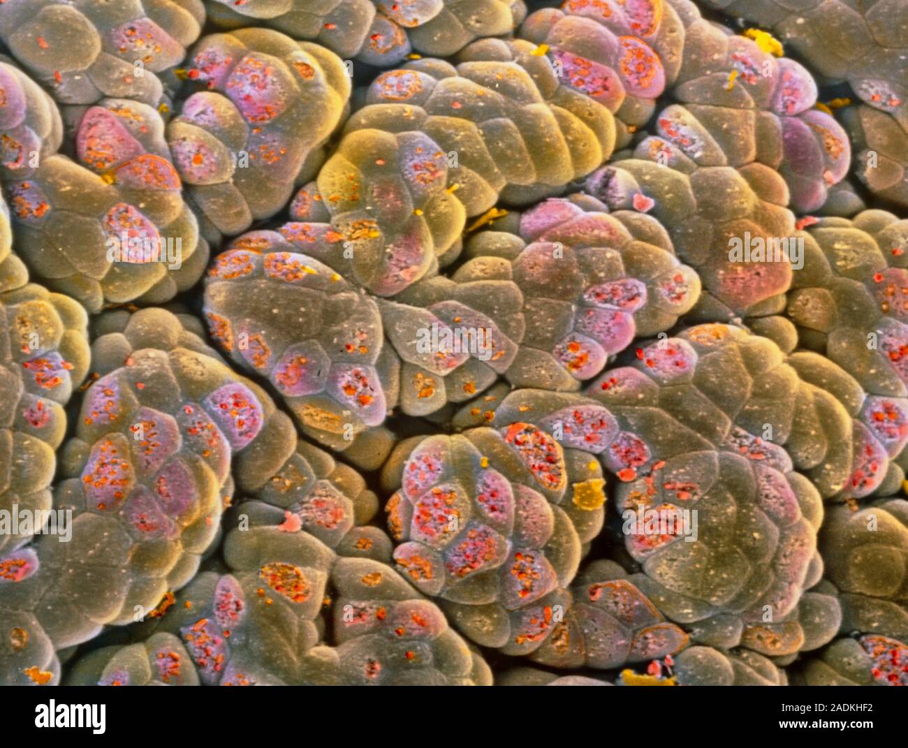 False-colour scanning electron micrograph (SEM) of acini cells of the ...