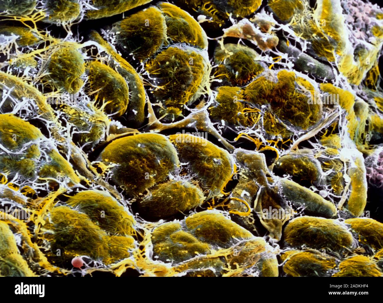 False-colour scanning electron micrograph (SEM) of acini cells of the ...