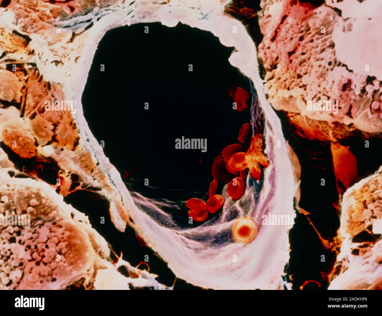 Pancreas. Coloured scanning electron micrograph of a sectioned small ...
