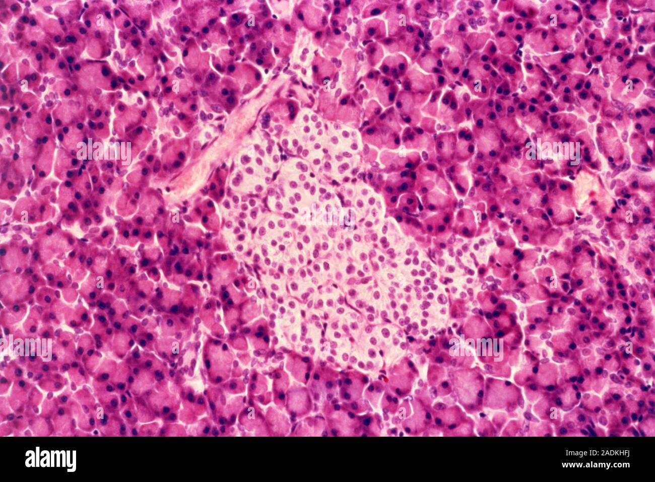 Pancreas. Light micrograph of a cross section through an islet of ...