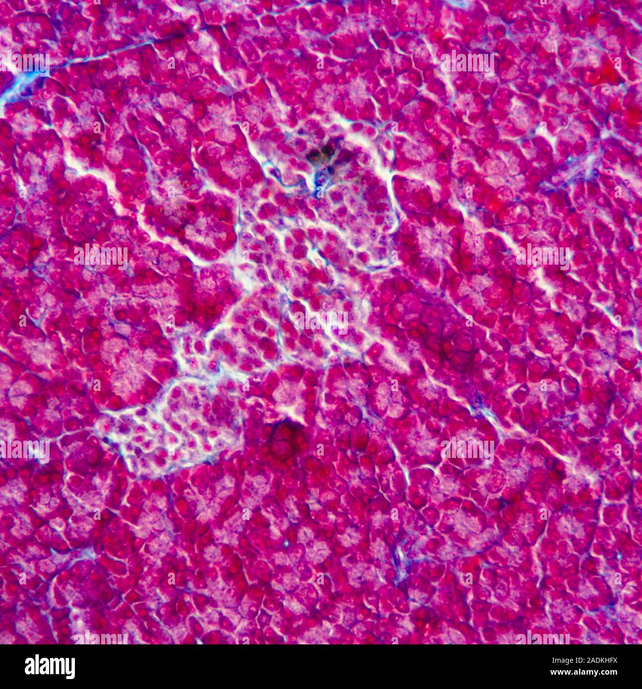 Pancreas. Light micrograph of a cross section through an islet of ...