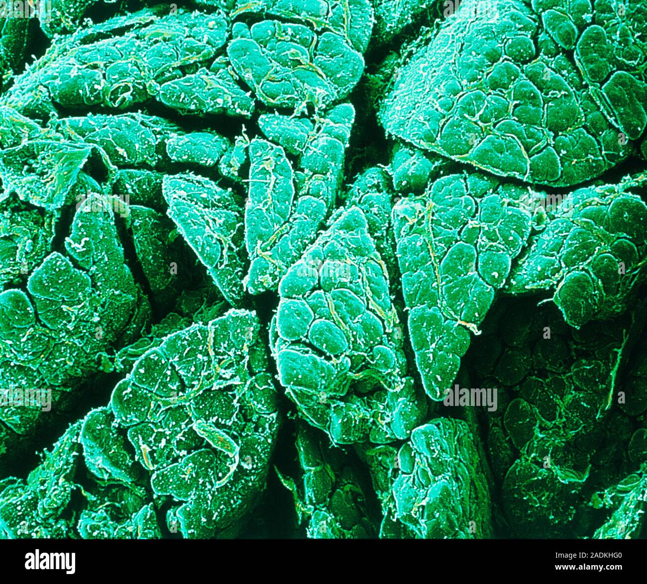 Pancreatic cells. Coloured scanning electron micrograph (SEM) of enzyme ...