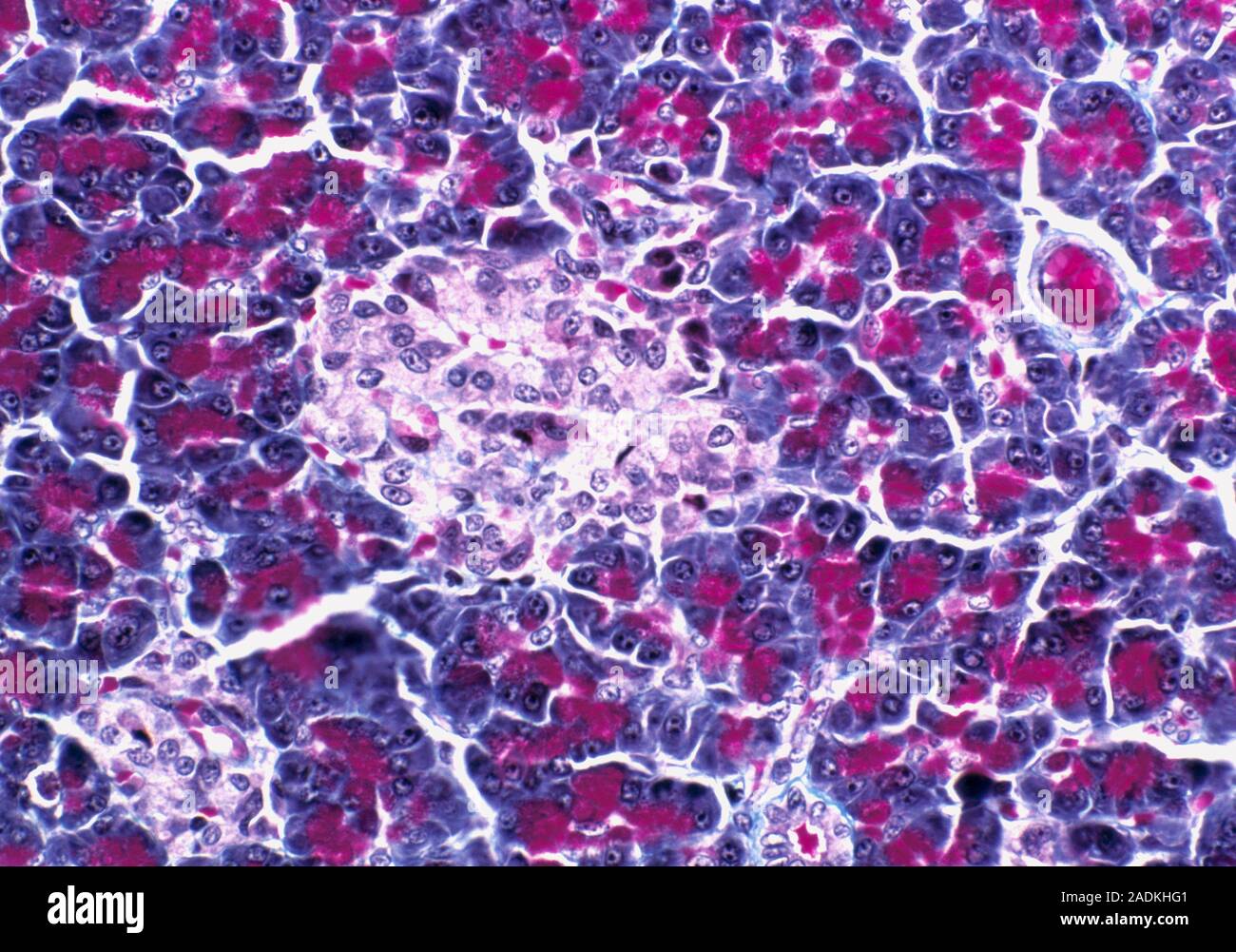 Islet of Langerhans. Light micrograph of a section through an islet of ...