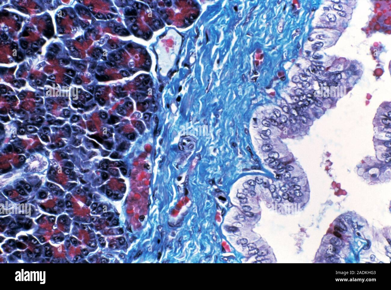 Pancreas tissue. Light micrograph of a section through exocrine tissue ...