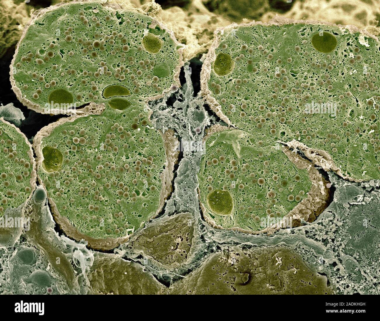 Pancreas cells. Coloured scanning electron micrograph (SEM) of acinar ... Pancreas cells. Coloured scanning electron micrograph (SEM) of acinar ...