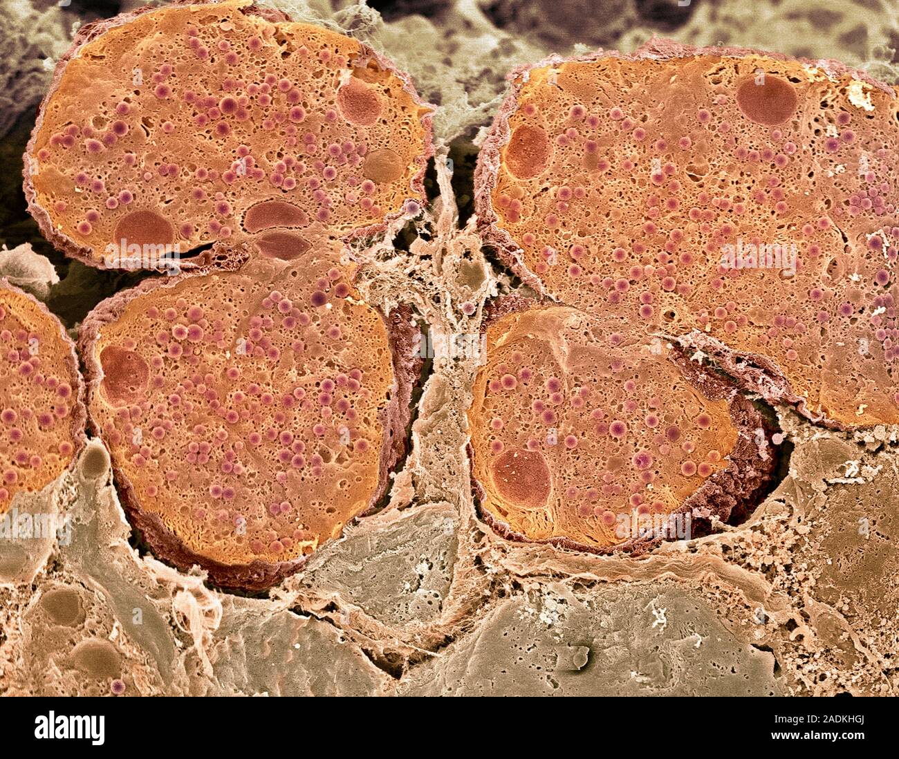 Pancreas cells. Coloured scanning electron micrograph (SEM) of acinar ... Pancreas cells. Coloured scanning electron micrograph (SEM) of acinar ...