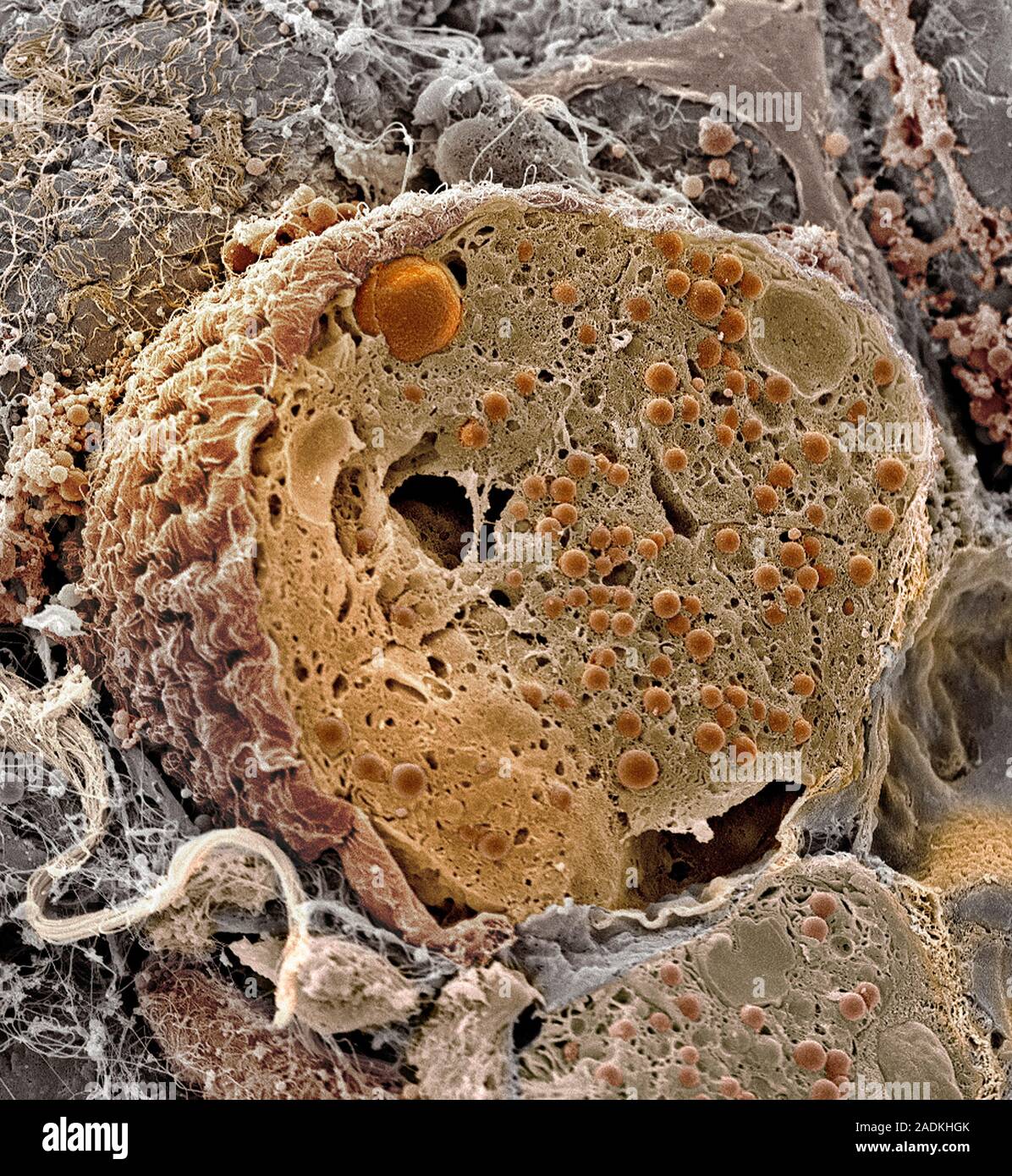 Pancreas cell. Coloured scanning electron micrograph (SEM) of an acinar ... Pancreas cell. Coloured scanning electron micrograph (SEM) of an acinar ...
