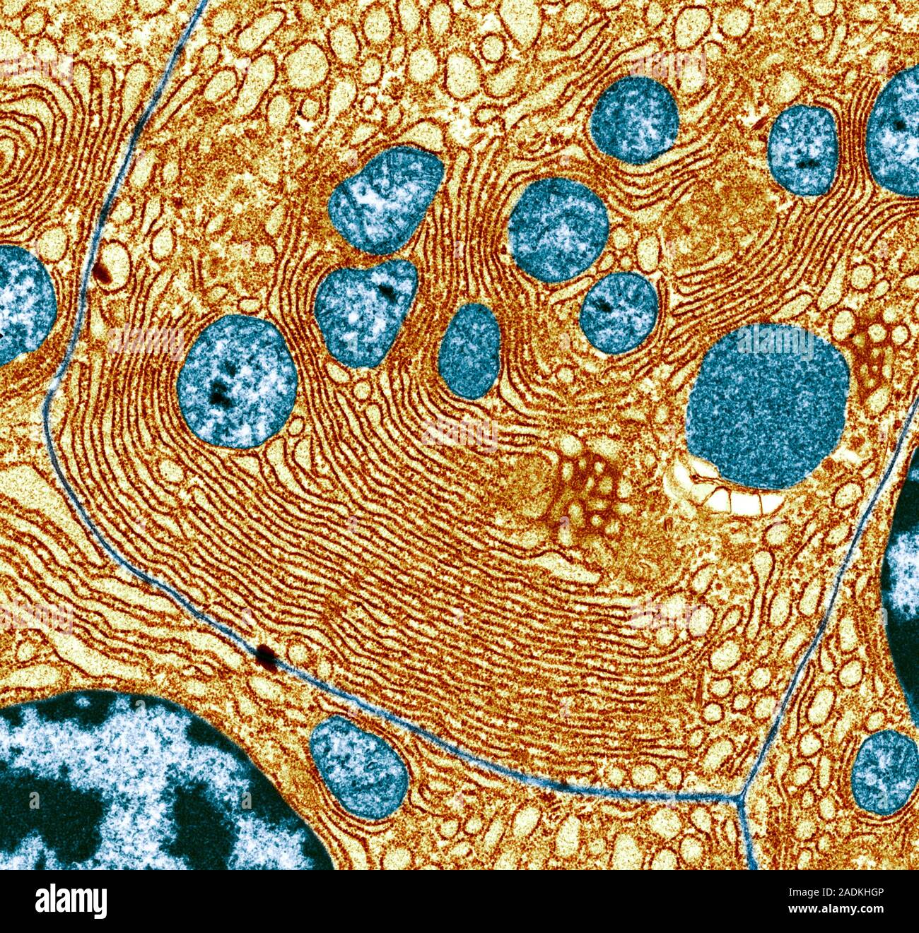 Pancreas cell. Coloured transmission electron micrograph (TEM) of part ... Pancreas cell. Coloured transmission electron micrograph (TEM) of part ...