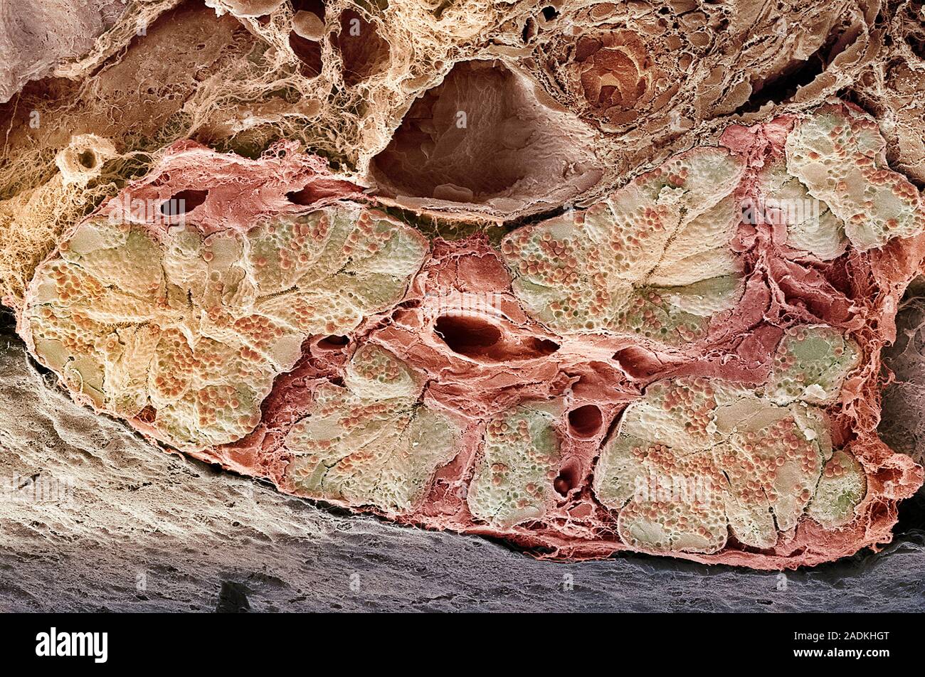 Pancreas tissue. Coloured scanning electron micrograph (SEM) of ...