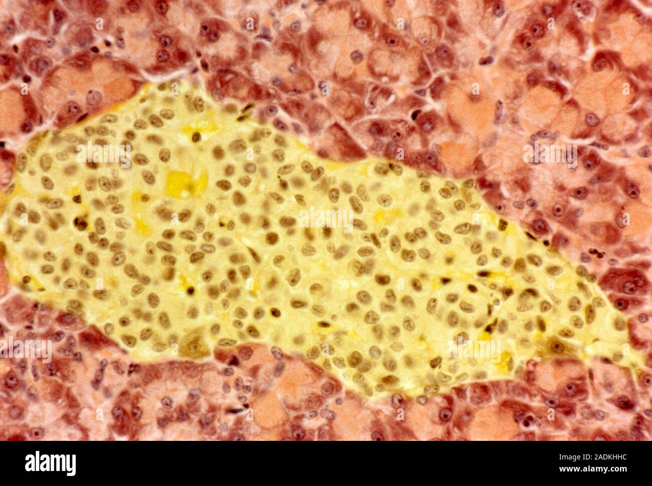 Islet of Langerhans. Light micrograph of a section through an islet of ...