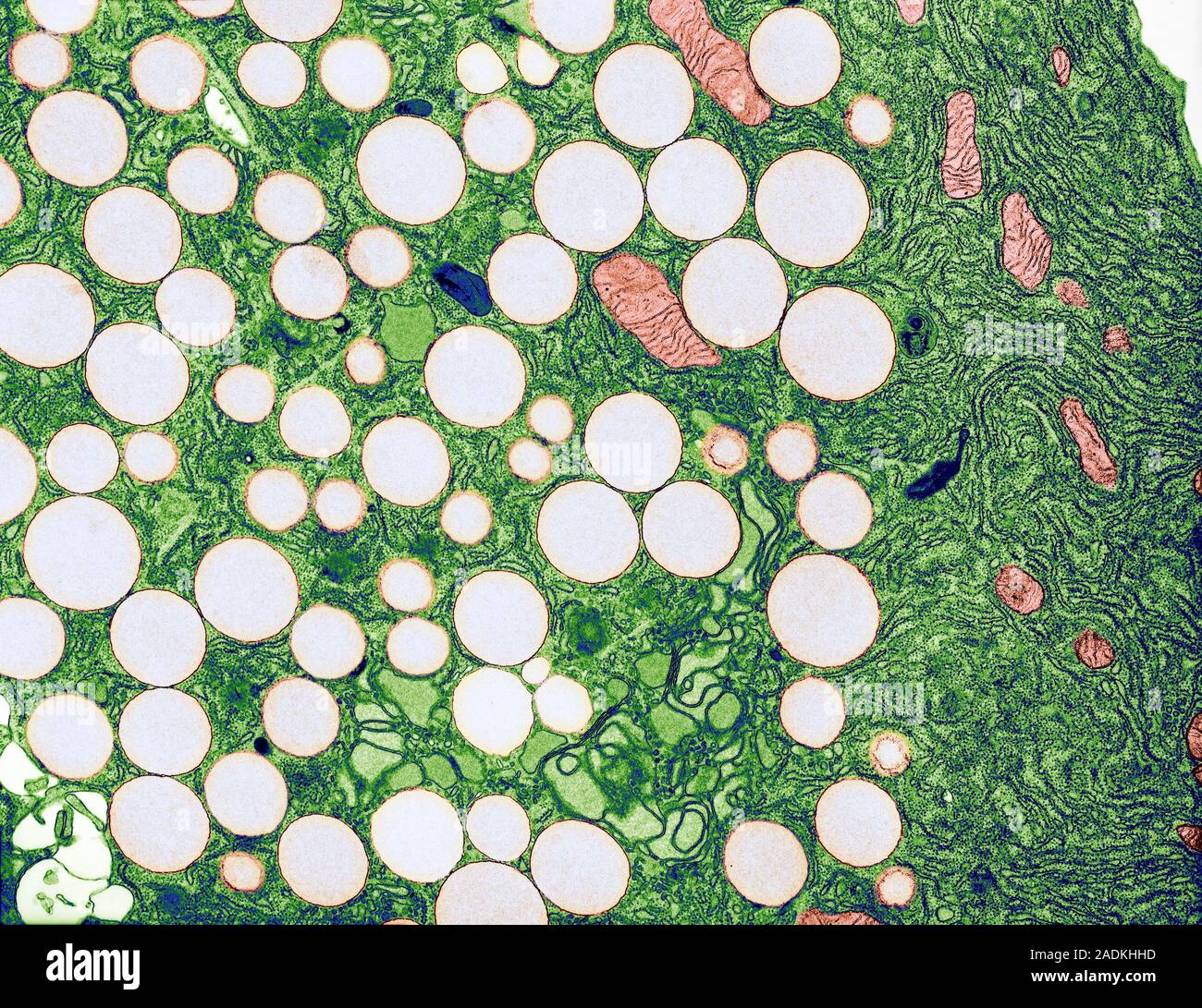 Pancreatic secretory cell. Coloured transmission electron micrograph ...