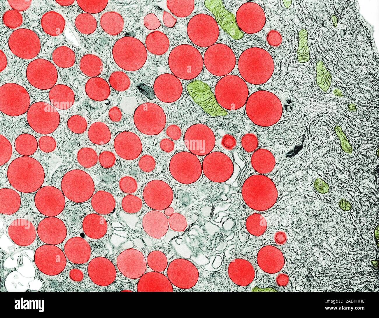 Pancreatic secretory cell. Coloured transmission electron micrograph ...