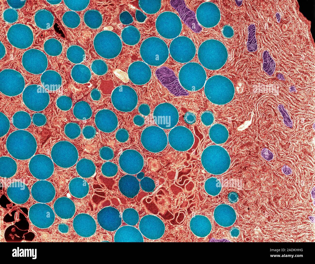Pancreatic secretory cell. Coloured transmission electron micrograph ...