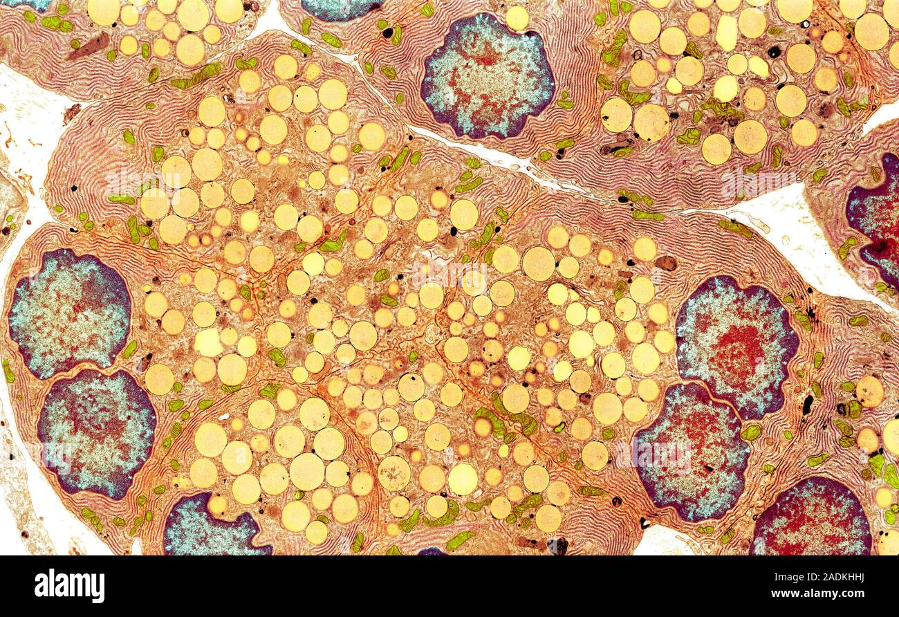 Pancreatic secretory cells. Coloured transmission electron micrograph ...
